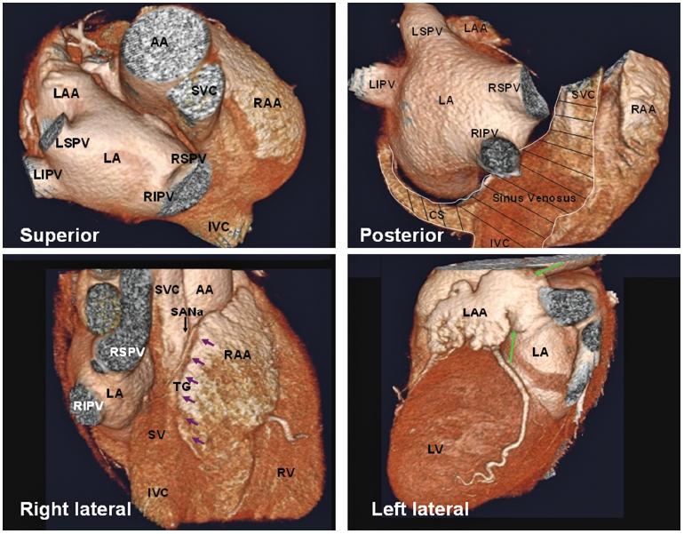 [PDF] Revisiting Cardiac Anatomy by Farhood Saremi eBook | Perlego
