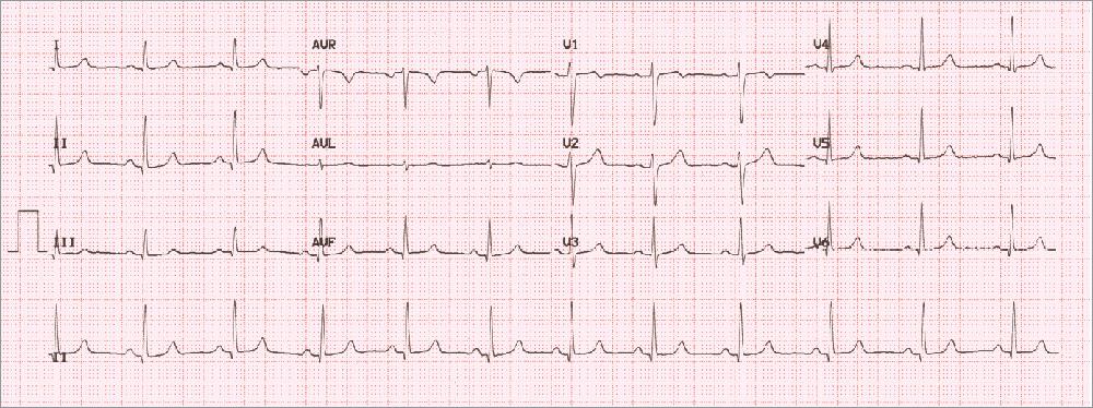 [PDF] The ECG Workbook by Angela Rowlands eBook | Perlego