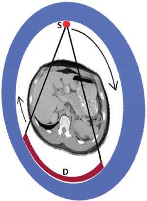 [PDF] CT Anatomy for Radiotherapy by Pete Bridge eBook | Perlego