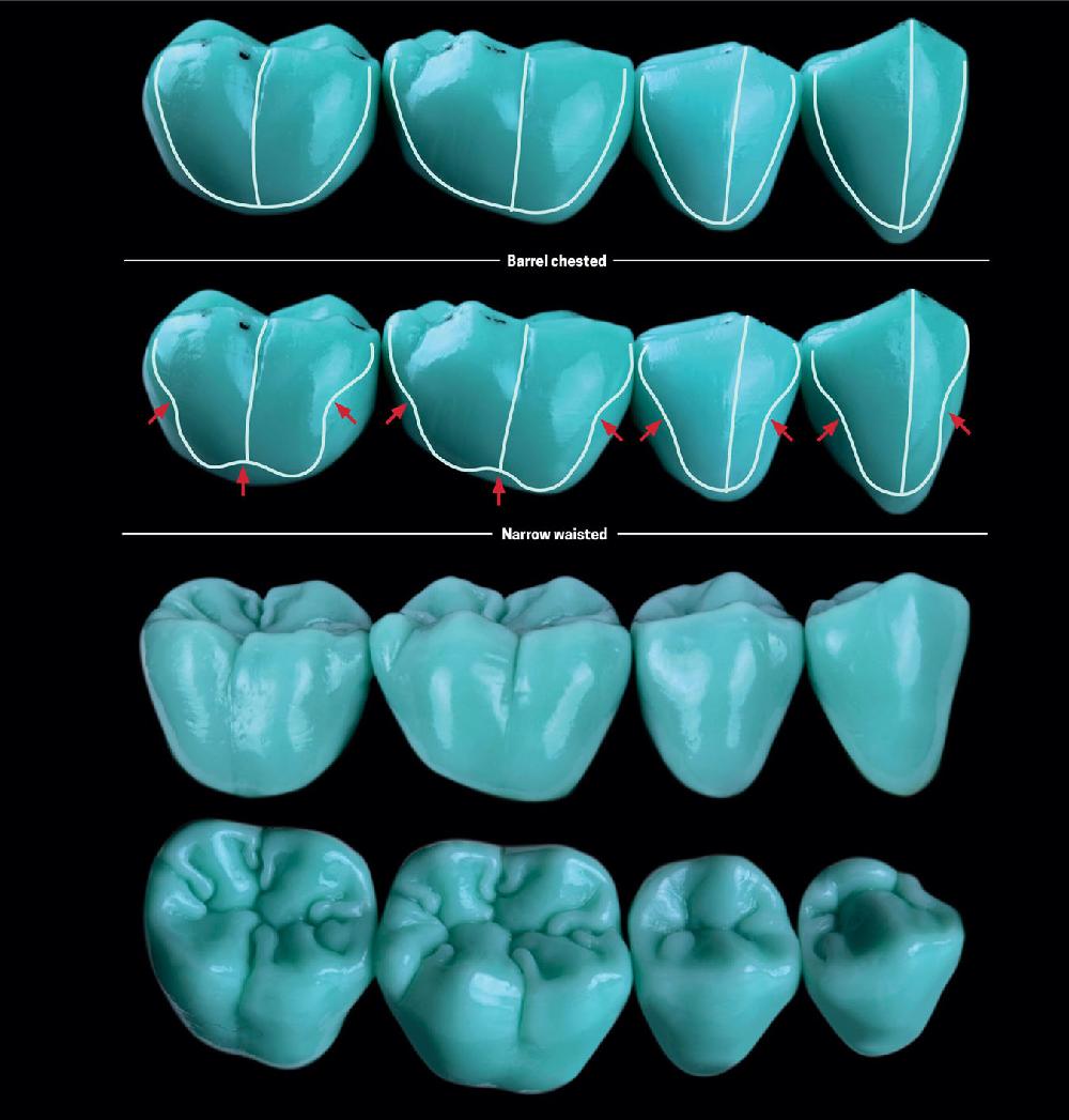 [PDF] Dental Anatomy and Morphology by Hilton Riquieri eBook | Perlego