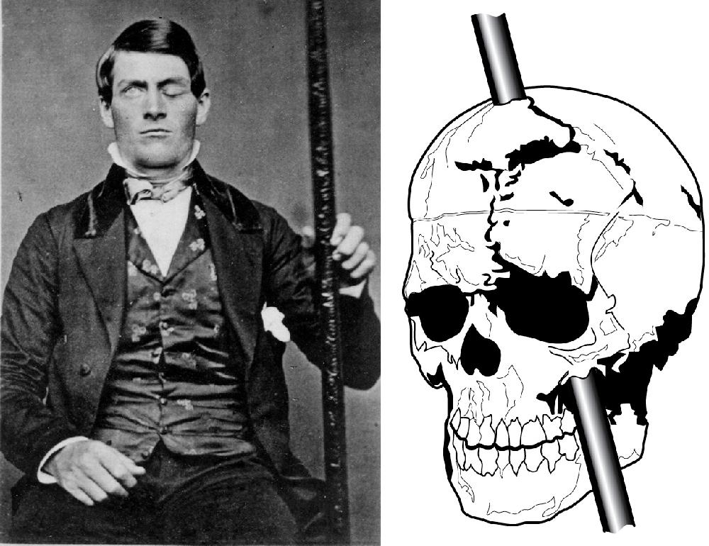 [PDF] Keep Sharp by Sanjay Gupta eBook | Perlego