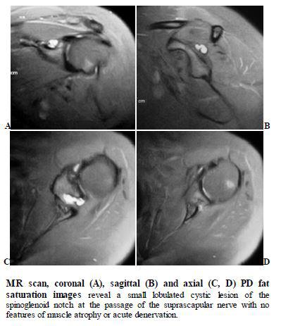 [PDF] Musculoskeletal Imaging by Ammar Haouimi eBook | Perlego