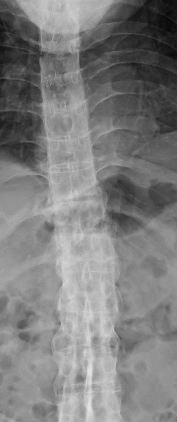 [PDF] A Complete Guide to the Final FRCR 2B by Deepak Subedi eBook ...