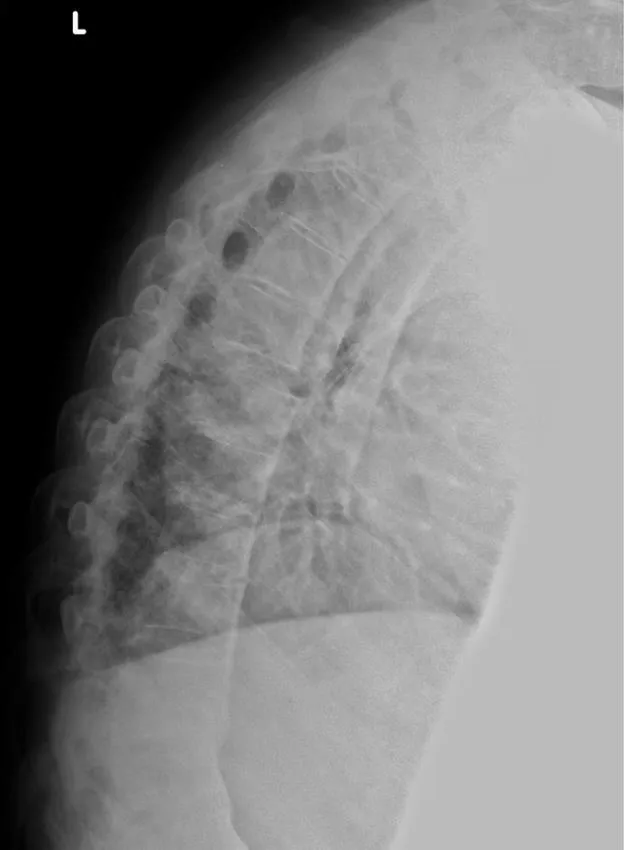 [PDF] A Complete Guide to the Final FRCR 2B by Deepak Subedi ...