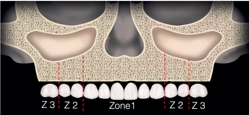 [PDF] The Immediacy Concept by Edmond Bedrossian eBook | Perlego