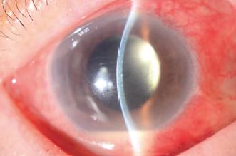 [PDF] Practical Guide to VIVA and OSCE in Ophthalmology Examinations by ...