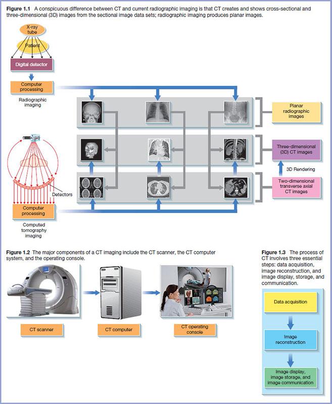 [PDF] CT at a Glance by Euclid Seeram eBook | Perlego